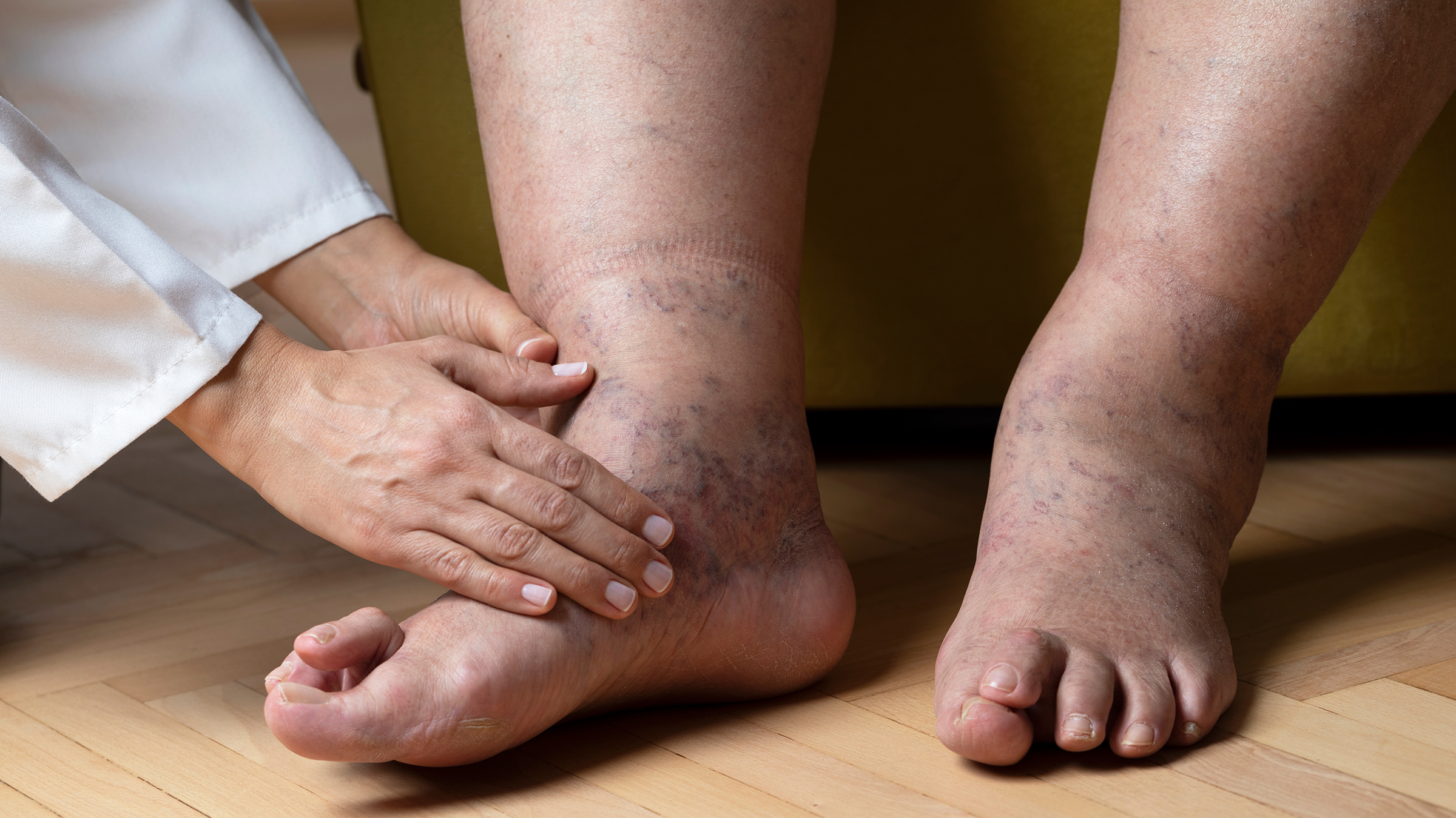 9 Common Foot Problems in Older Adults and How to Manage Them - GoodRx