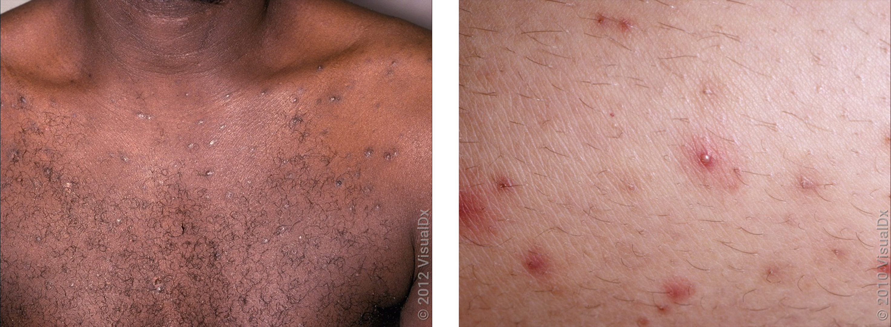 Bumps On Skin