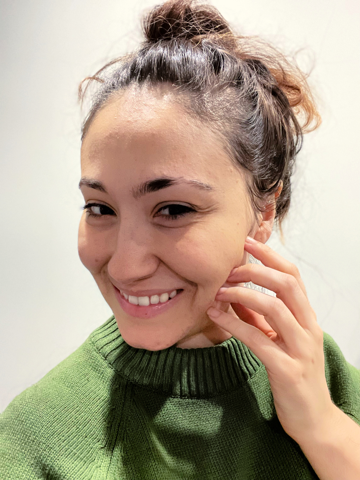 Dealing With Alopecia at Work: How I Navigated My Hair Loss - GoodRx