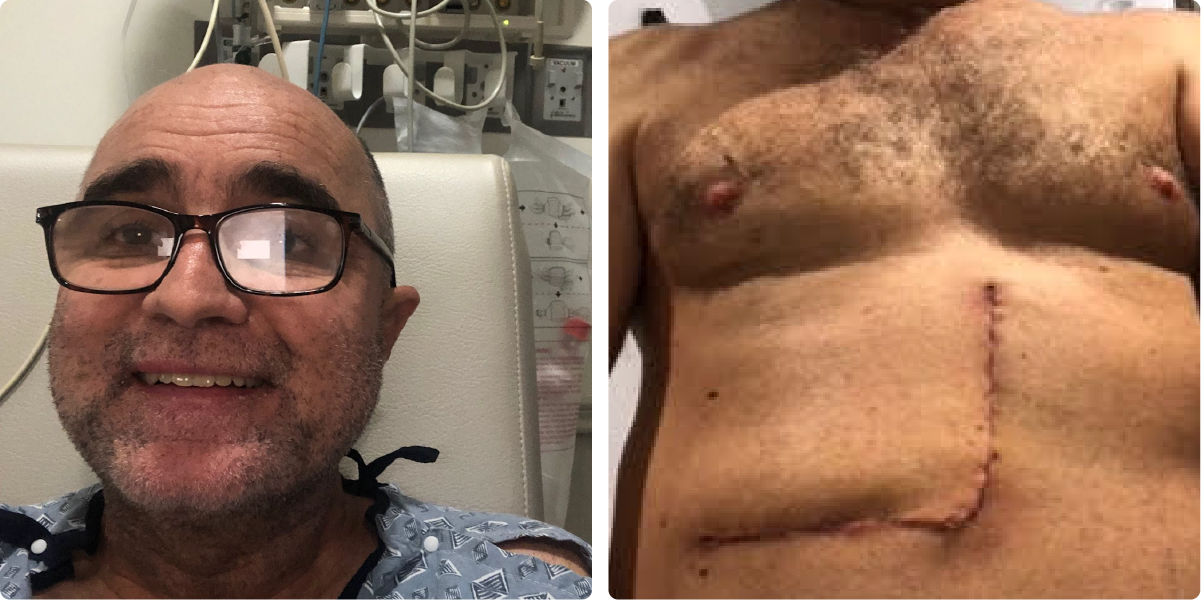 Post-Organ Donation: What It’s Like Being a Living Organ Donor - GoodRx