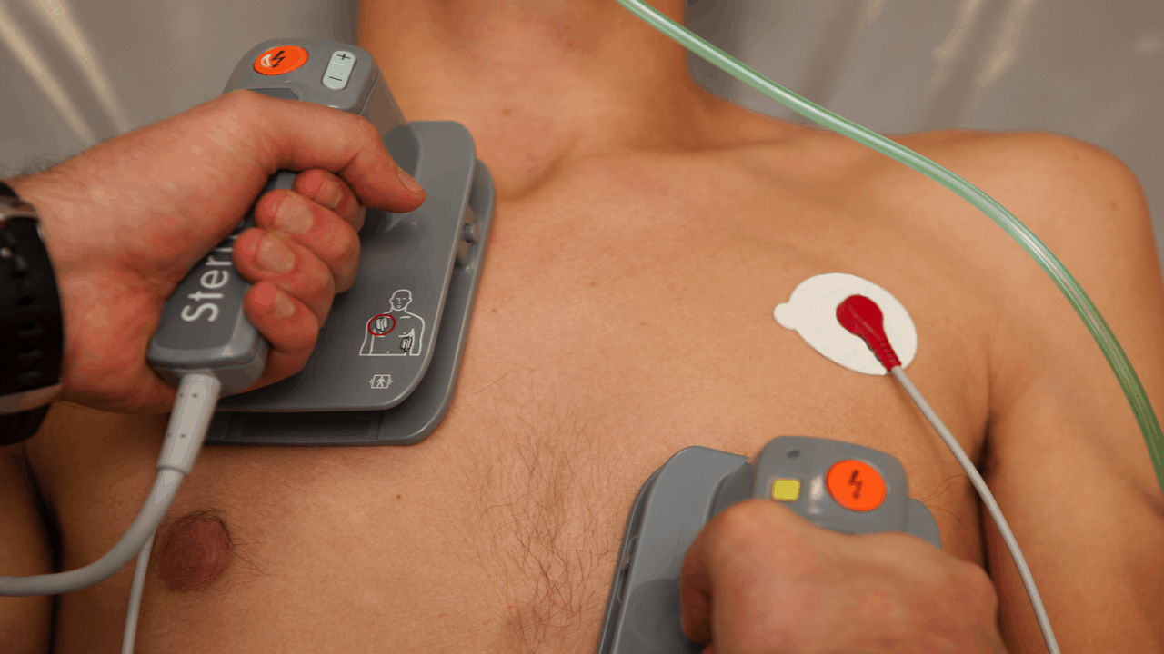 Treating Atrial Fibrillation: Options You Should Know About - GoodRx