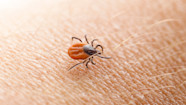 What Are The Different Types Of Tick Borne Diseases GoodRx