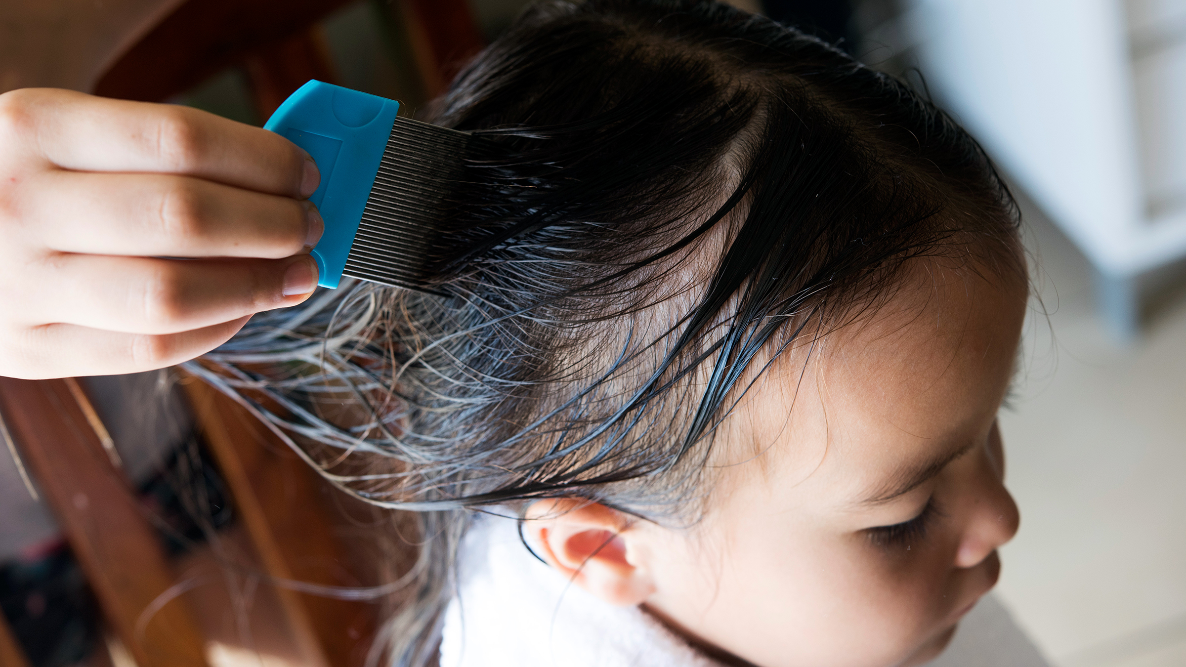 How to Get Rid of Head Lice: The 6 Most Effective Natural Options - GoodRx