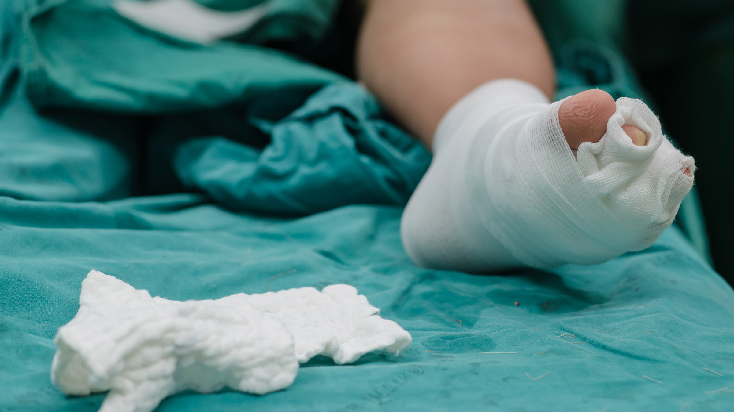 What Should I Do for a Broken Toe? - GoodRx