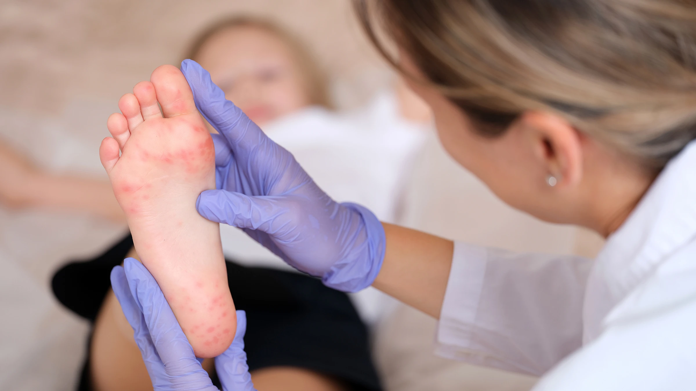 How Long Is Hand, Foot, and Mouth Disease Contagious? - GoodRx