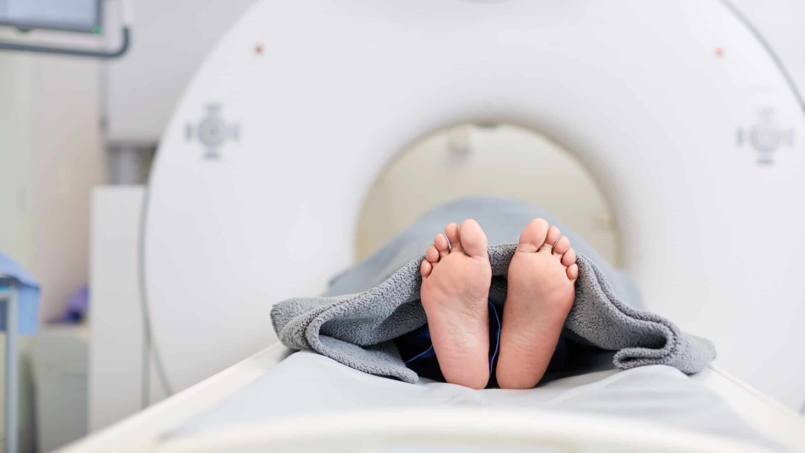 Lung Cancer Tests: How Doctors Screen for Lung Cancer - GoodRx