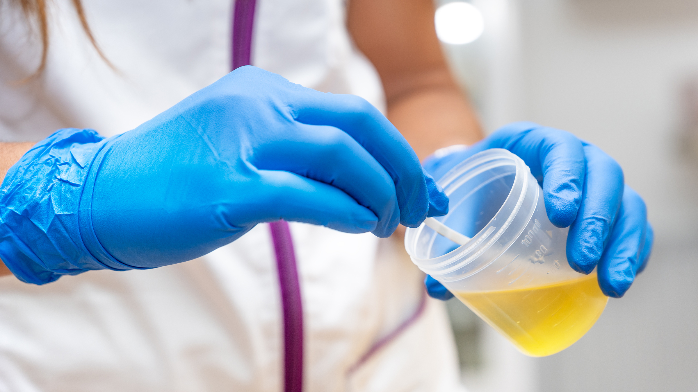 Pee Color Meaning: What Urine Says About Your Health - GoodRx