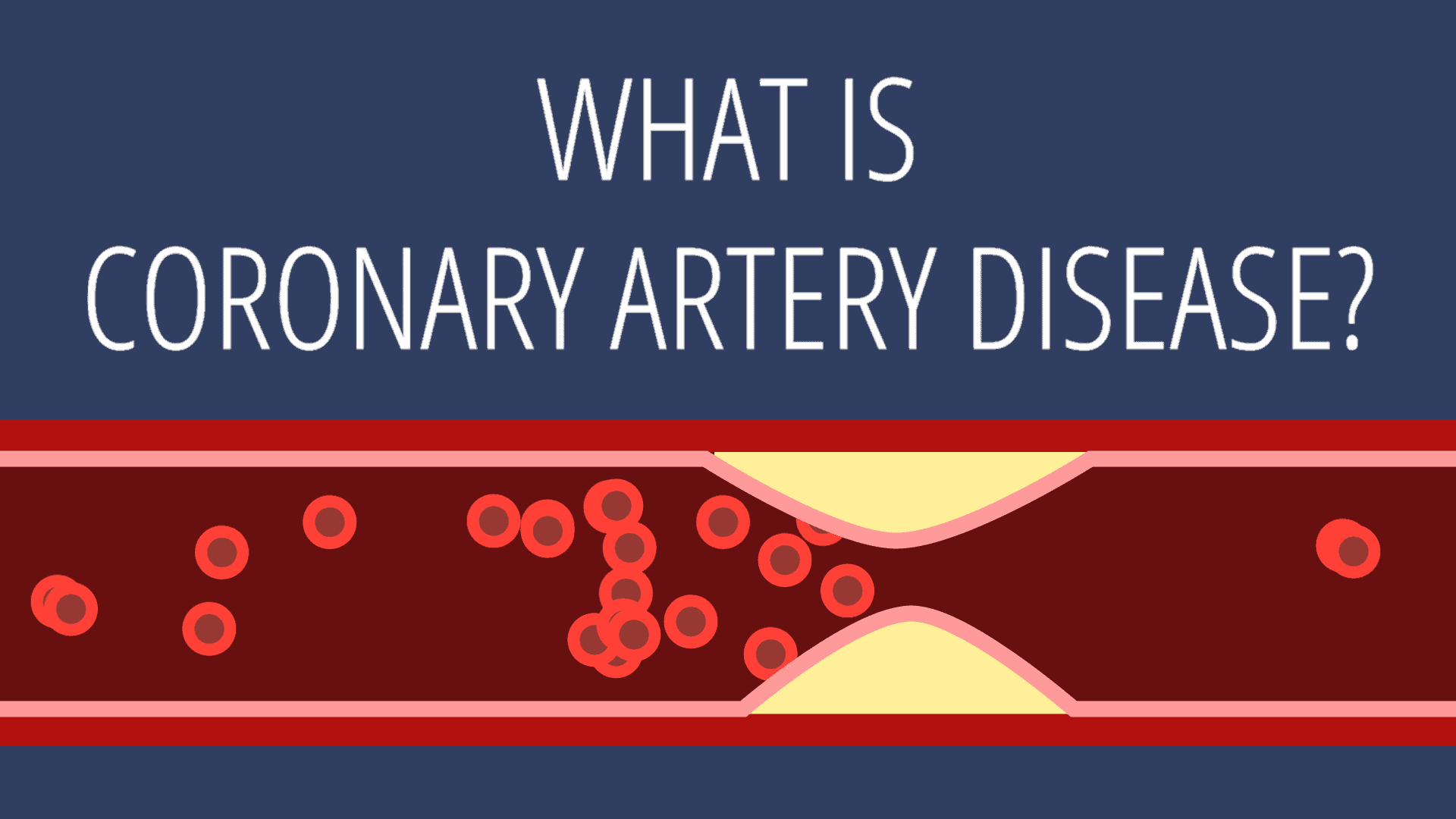 Coronary Artery Disease, Explained in Less Than 2 Minutes - GoodRx