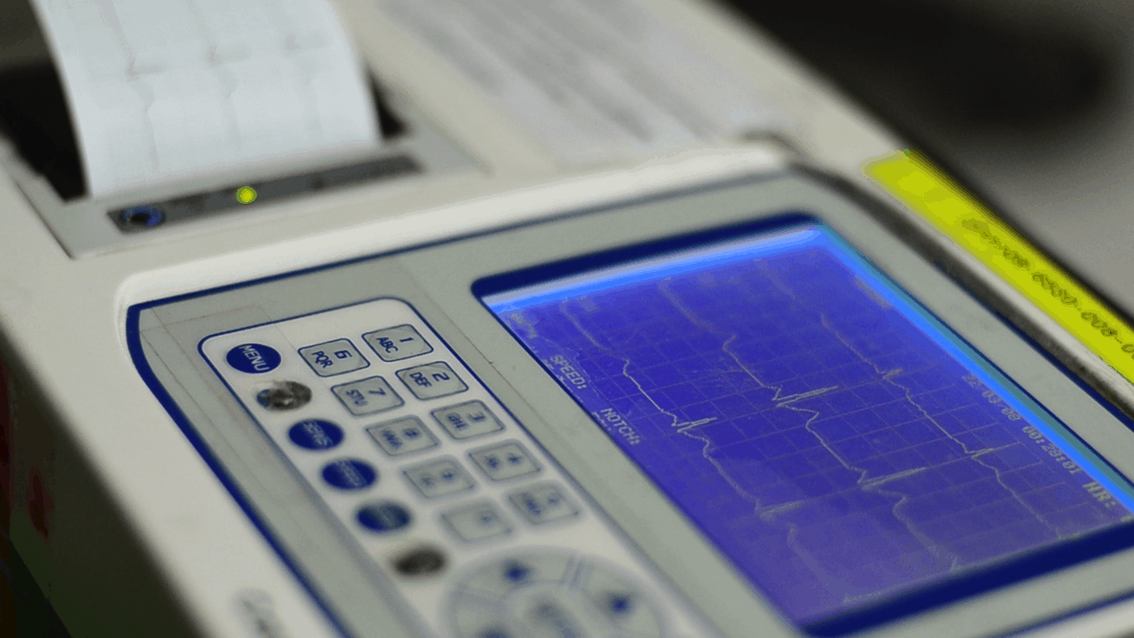 What Is Atrial Fibrillation? Causes and Symptoms You Should Know - GoodRx