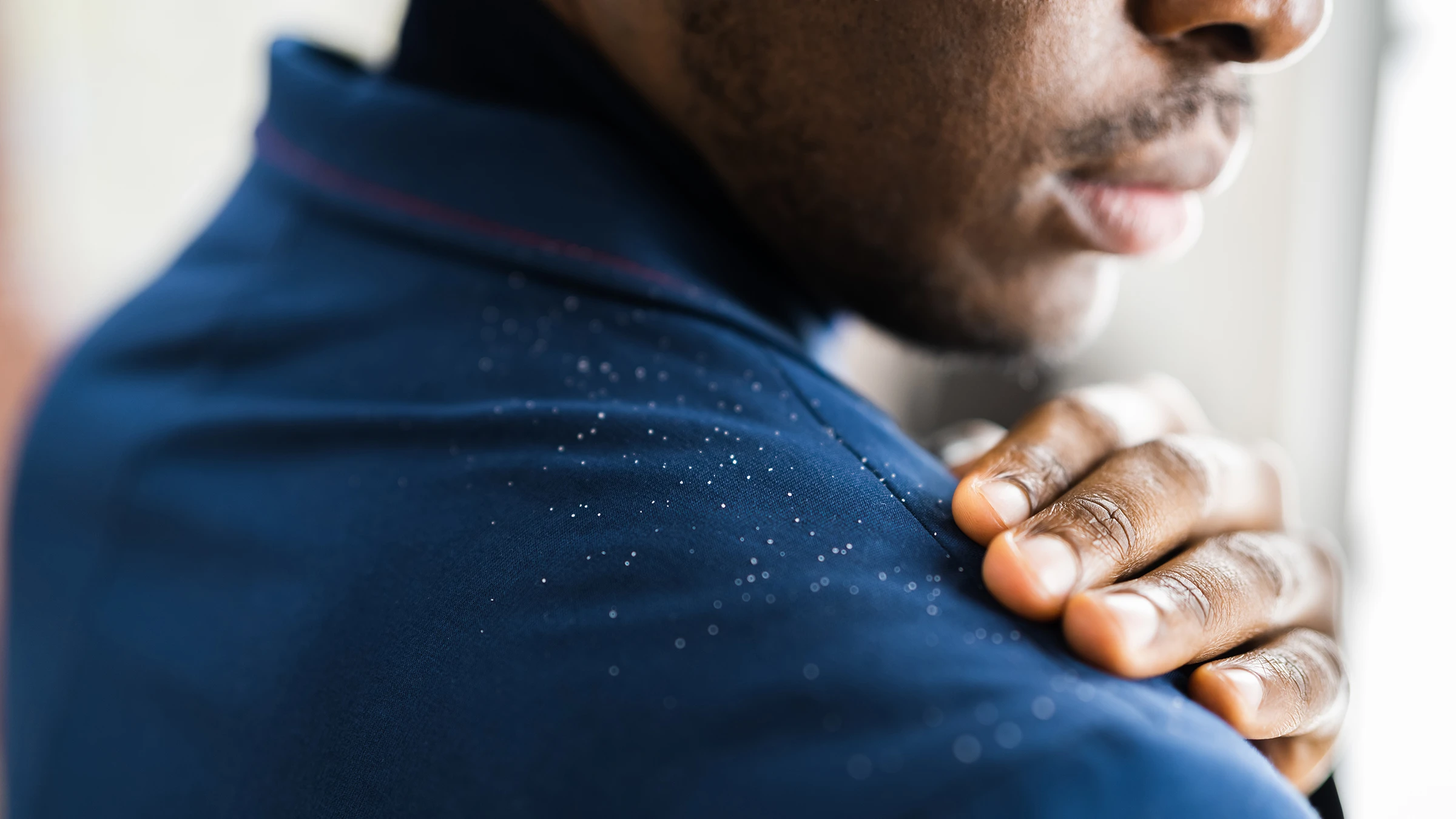 9 Dandruff Causes and How to Avoid Them (With Pictures) - GoodRx
