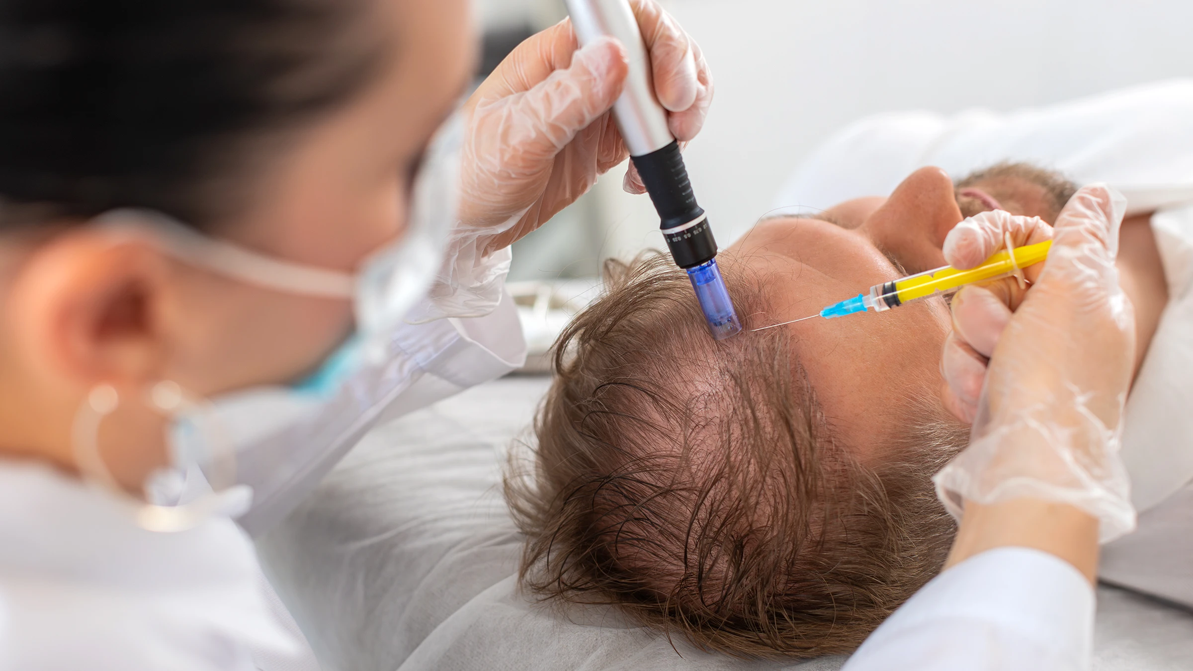 Does Insurance Cover Hair Loss Treatment ? A GoodRx Guide - GoodRx