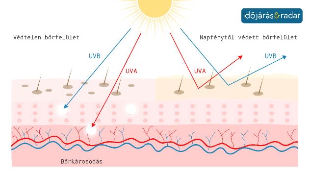 UV-sugárzás hatásai - Amit érdemes tudni - Időjárás Top Téma