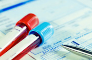 Prediabetes borderline Diabetes Diagnosis