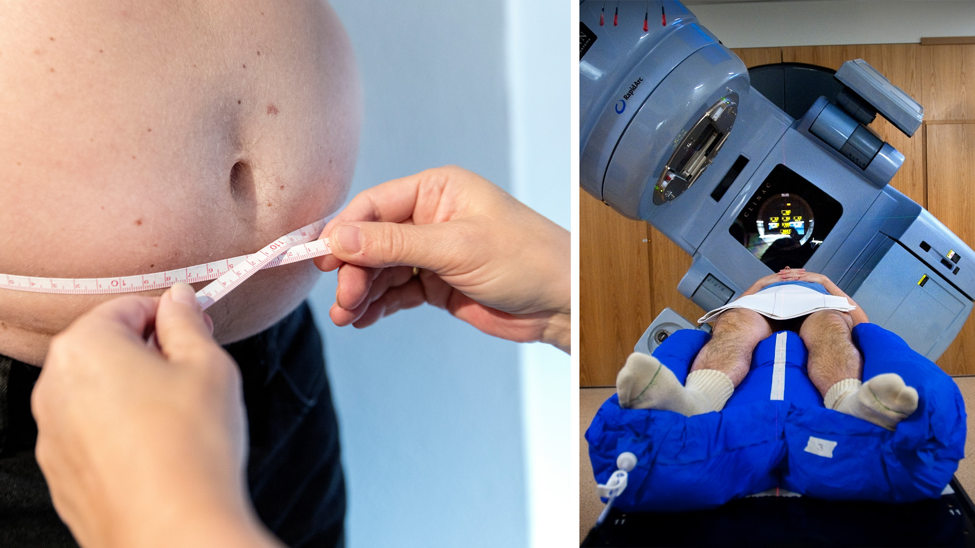 Fetma skulle kunna öka risken för 18 nya cancerformer