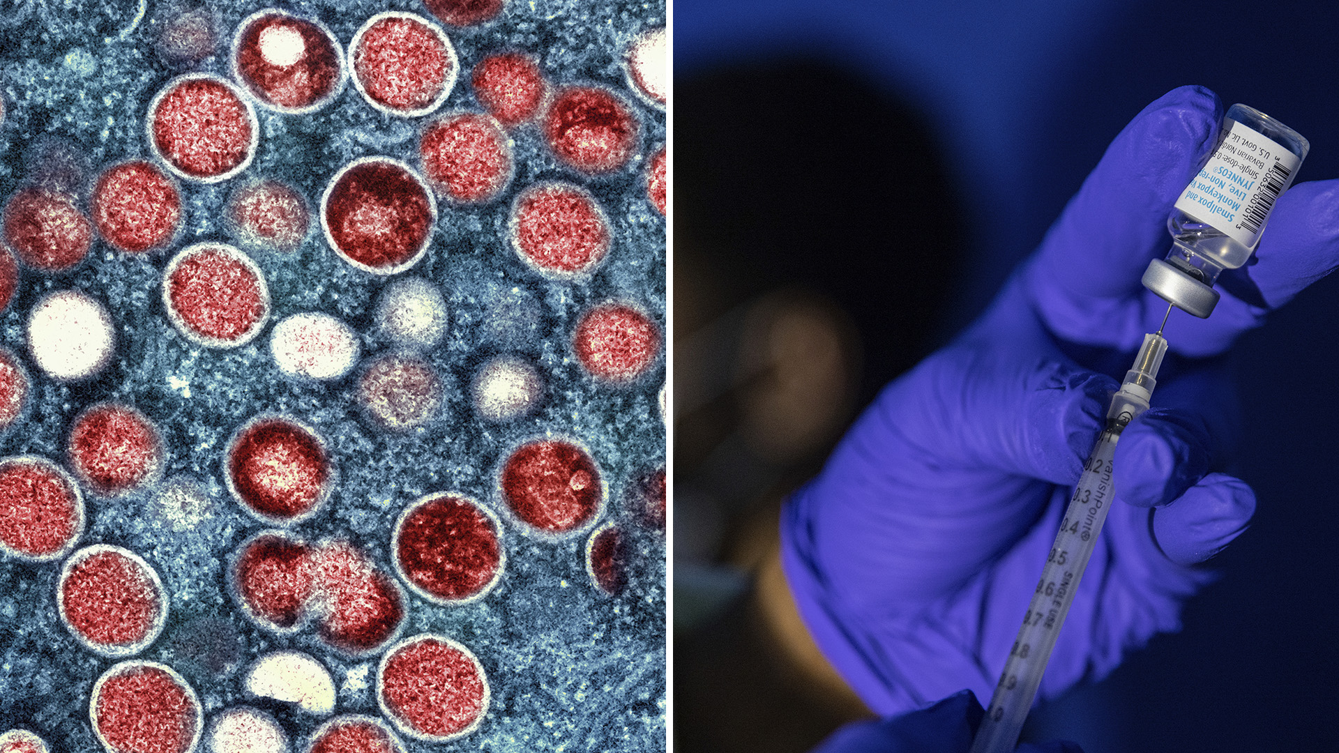 WHO klassar mpox som en global folkhälsokris