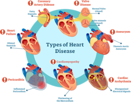 Cardiovascular Diseases Study Guide Inspirit