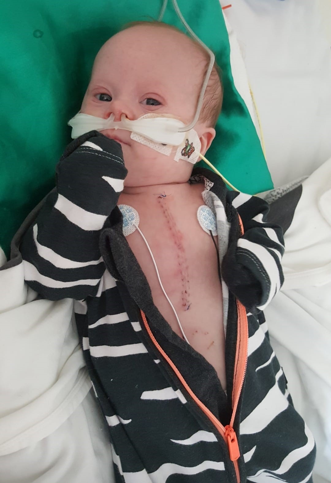 Oliver's story | Starlight Children's Foundation | Australian Children ...