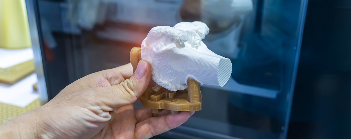 How Additive Manufacturing Is Revolutionizing Medical Implants — MSC ...