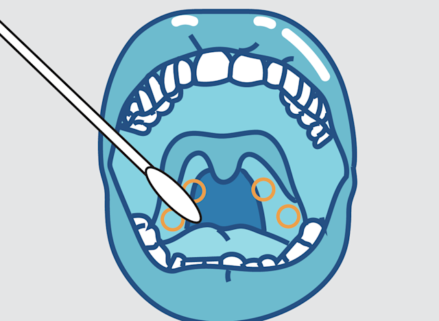 How To Use A Throat Swab Kit | Home STI Test | SH:24