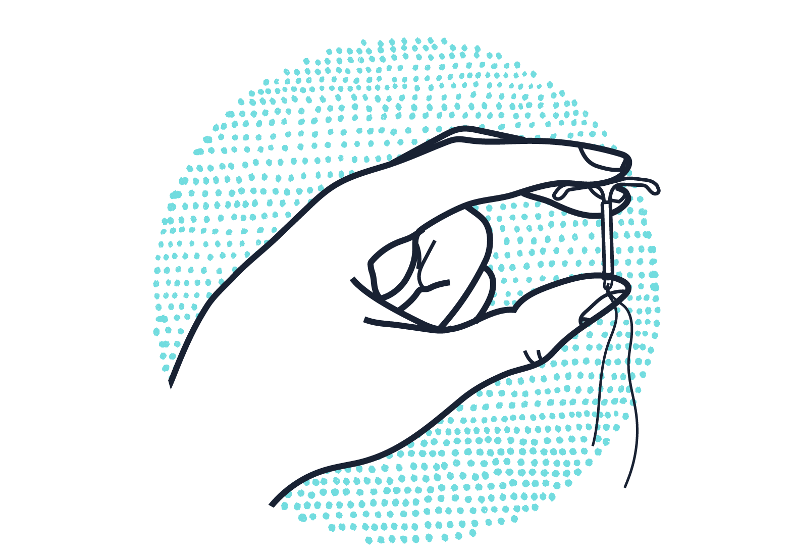 Hormonal Coil Information | SH:24
