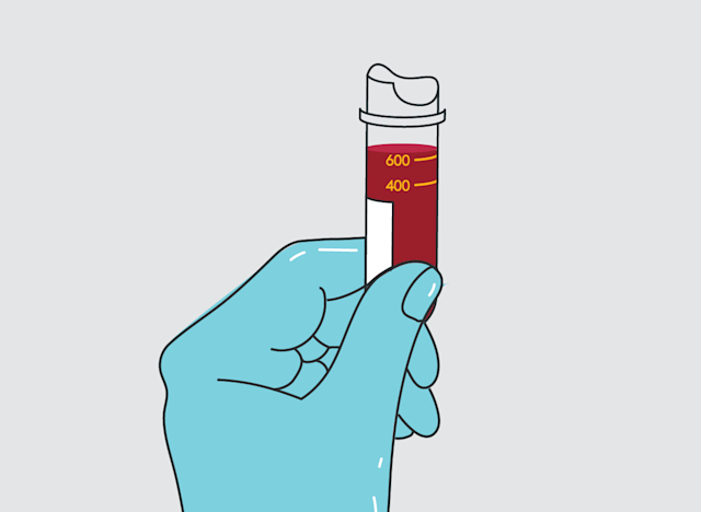 How To Take a Blood Sample | Home STI Test | SH:24