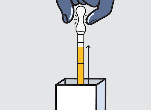 How To Take a Urine Sample | Home STI Test | SH:24
