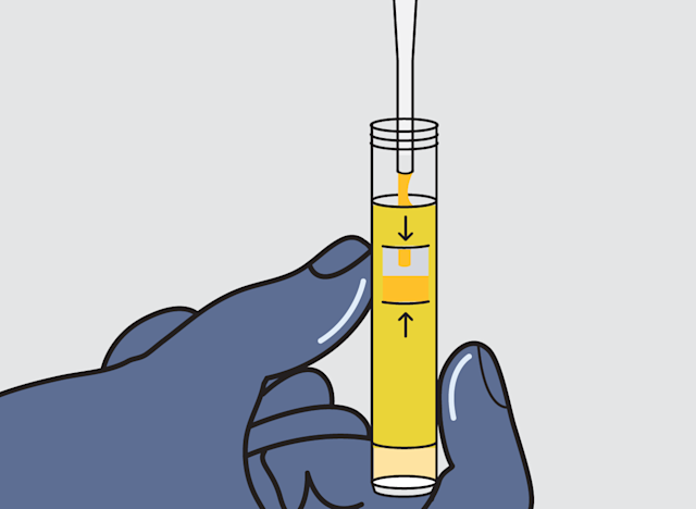How To Take a Urine Sample | Home STI Test | SH:24