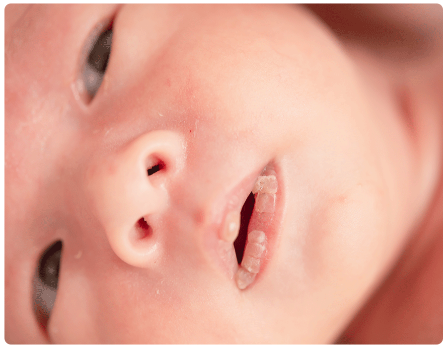 toddler keeps pouting lips