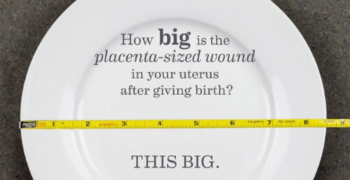 Placenta-Sized Plate Shows the Importance of Recovery After Childbirth