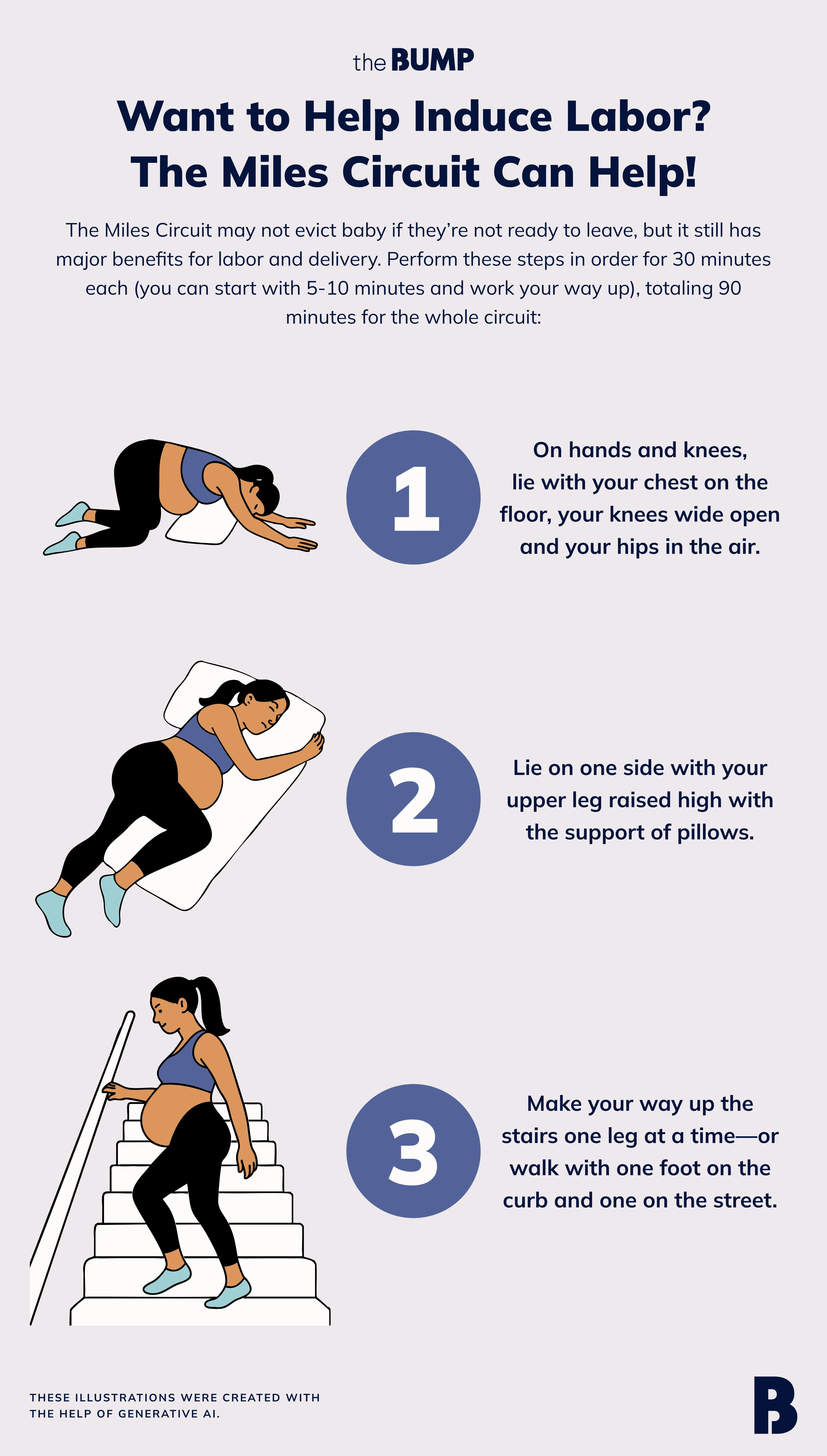 Miles Circuit to Induce Labor: Does It Work?