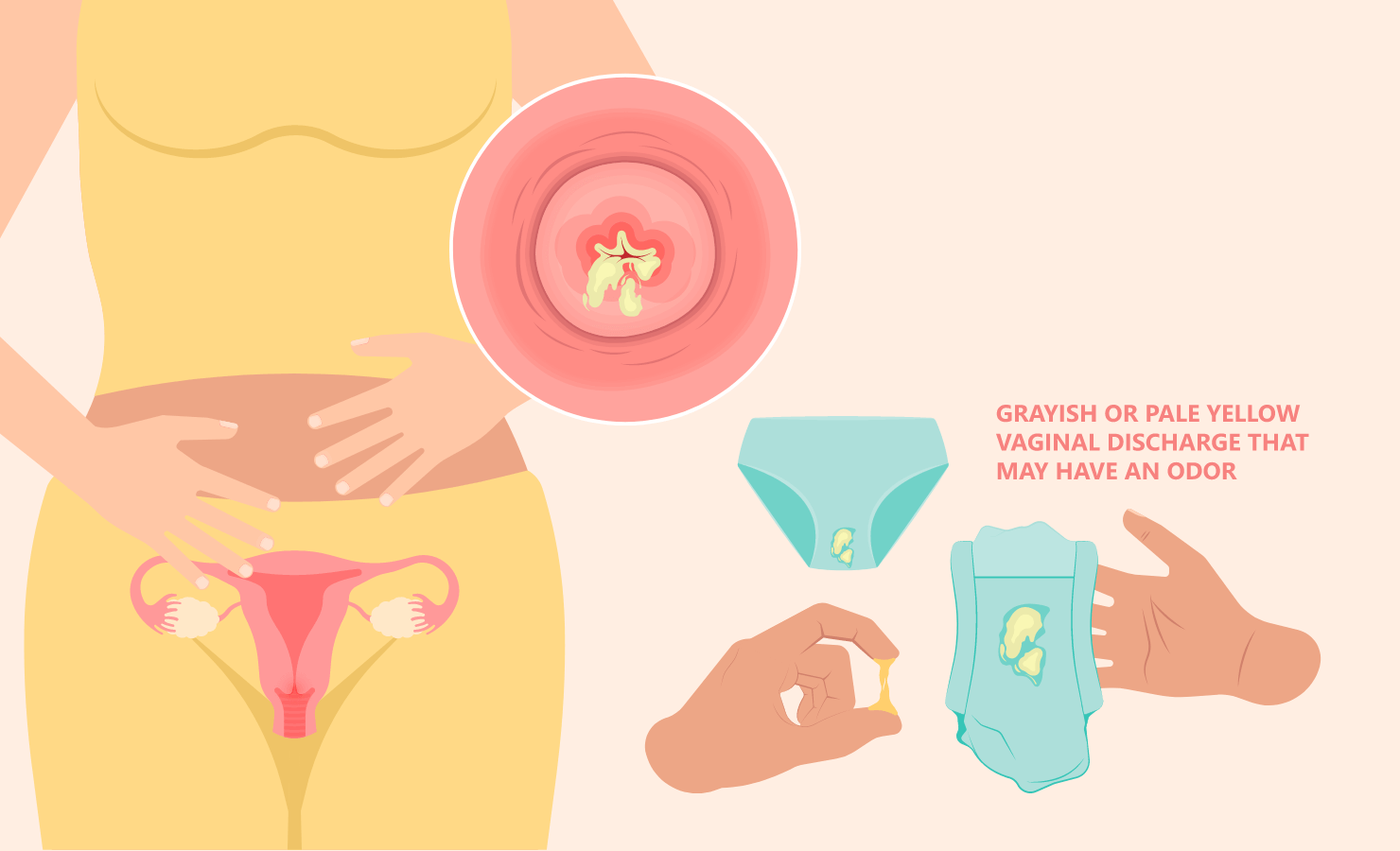 cervical fluid types