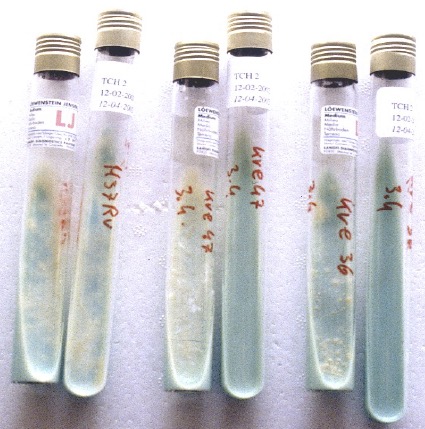 TB colonies