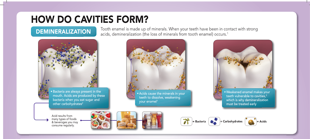 How Do Cavities Form? | Kenvue Health Professionals