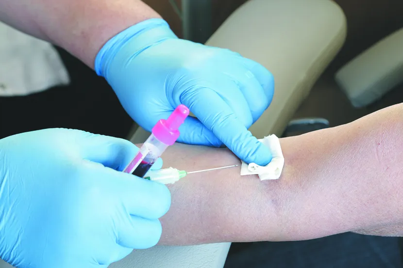 Morfologia krwi w diagnostyce chorób hematologicznych - Puls Medycyny