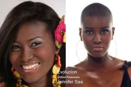 Miss Venezuela podría ser muy morena, calva y sin un dedo ...