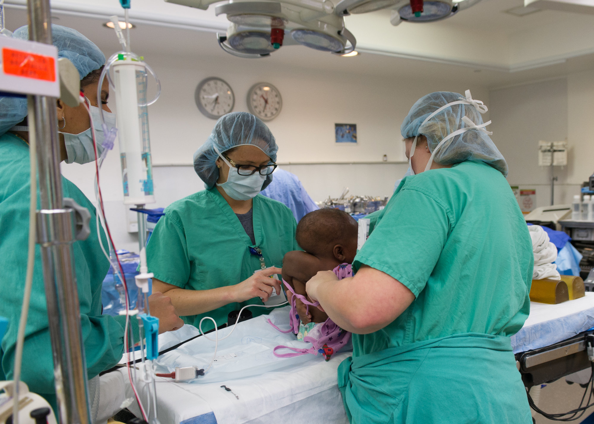 Bebé con cuatro piernas y dos columbas operada con éxito (FOTOS ...