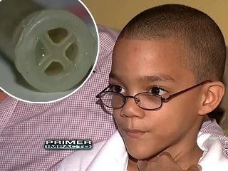 En Nueva York extraen pito de goma de los pulmones de niño latino ...