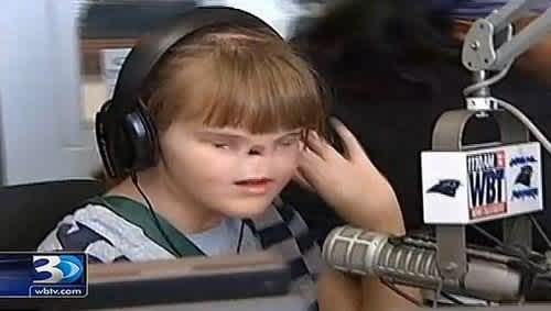Nació Sin Ojos Ni Nariz Y Tendrá El Perfil Con El Que Siempre Soñó