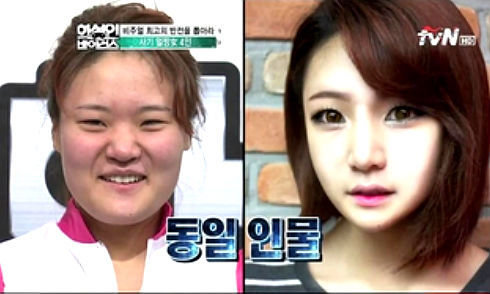 SEE 7 crazy before and after plastic surgery photos (PHOTOS ...