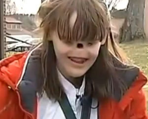 ¡Cassidy Hopper está feliz porque por fin tendrá una nariz ...