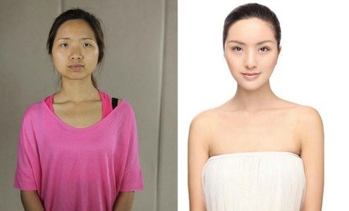 Extreme plastic surgery transformations from China will shock you ...