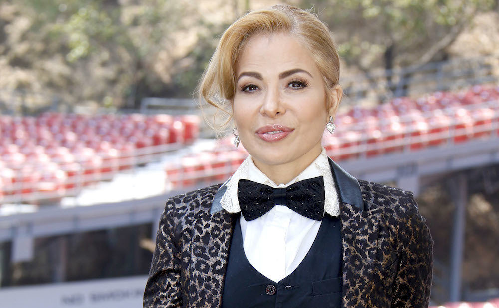 A Gloria Trevi le inventan un escándalo por usar botox + 10 famosas que ...