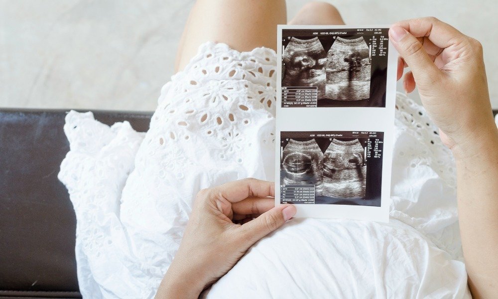 SEE: Sonogram of baby smiling in the womb is cute & freaky all at once ...