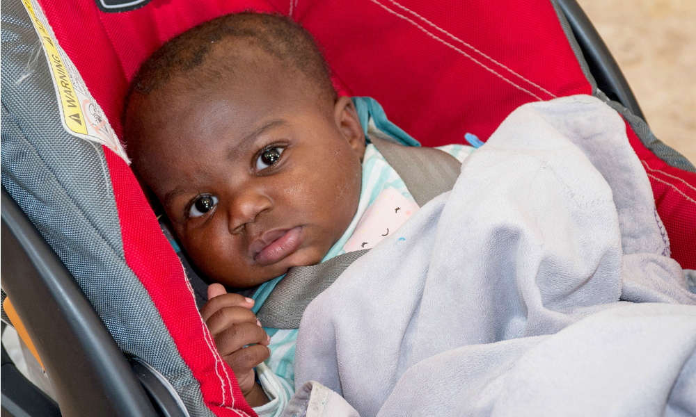 Bebé con cuatro piernas y dos columbas operada con éxito (FOTOS ...
