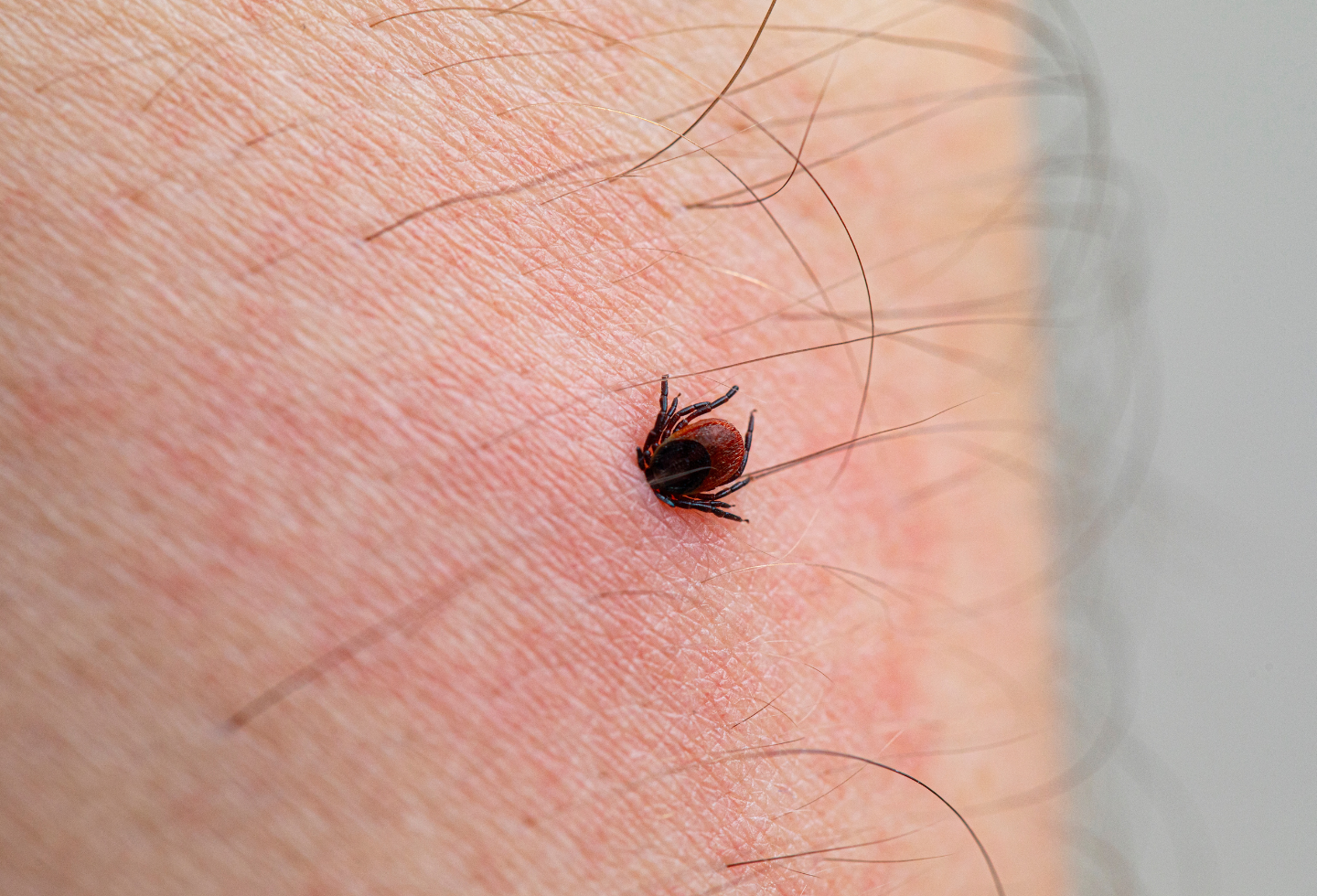 Tick Treatment, Prevention and Control | Expert Advice