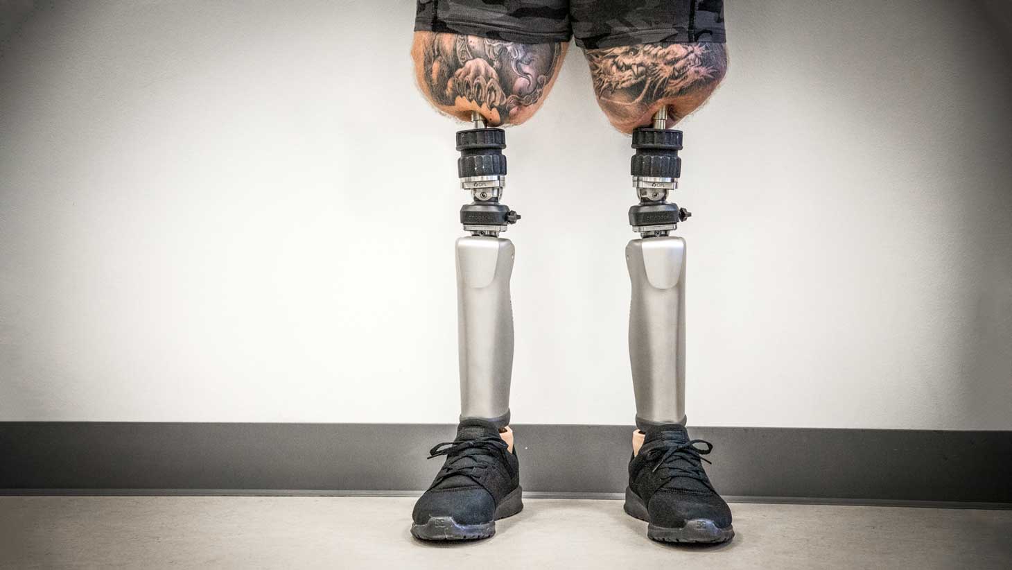 Afghanistanveteran: Nye proteser har givet mig livsglæden tilbage ...