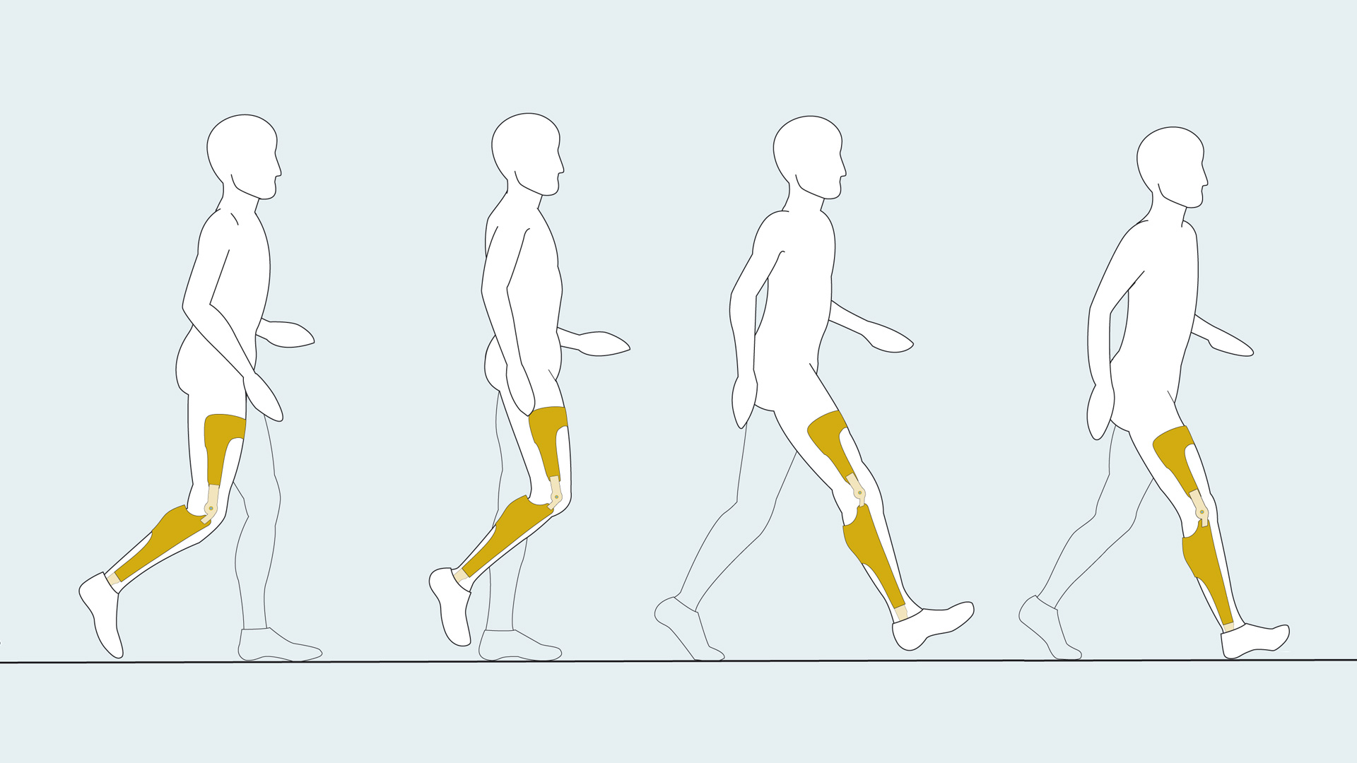 Stance Control Orthotics Explained