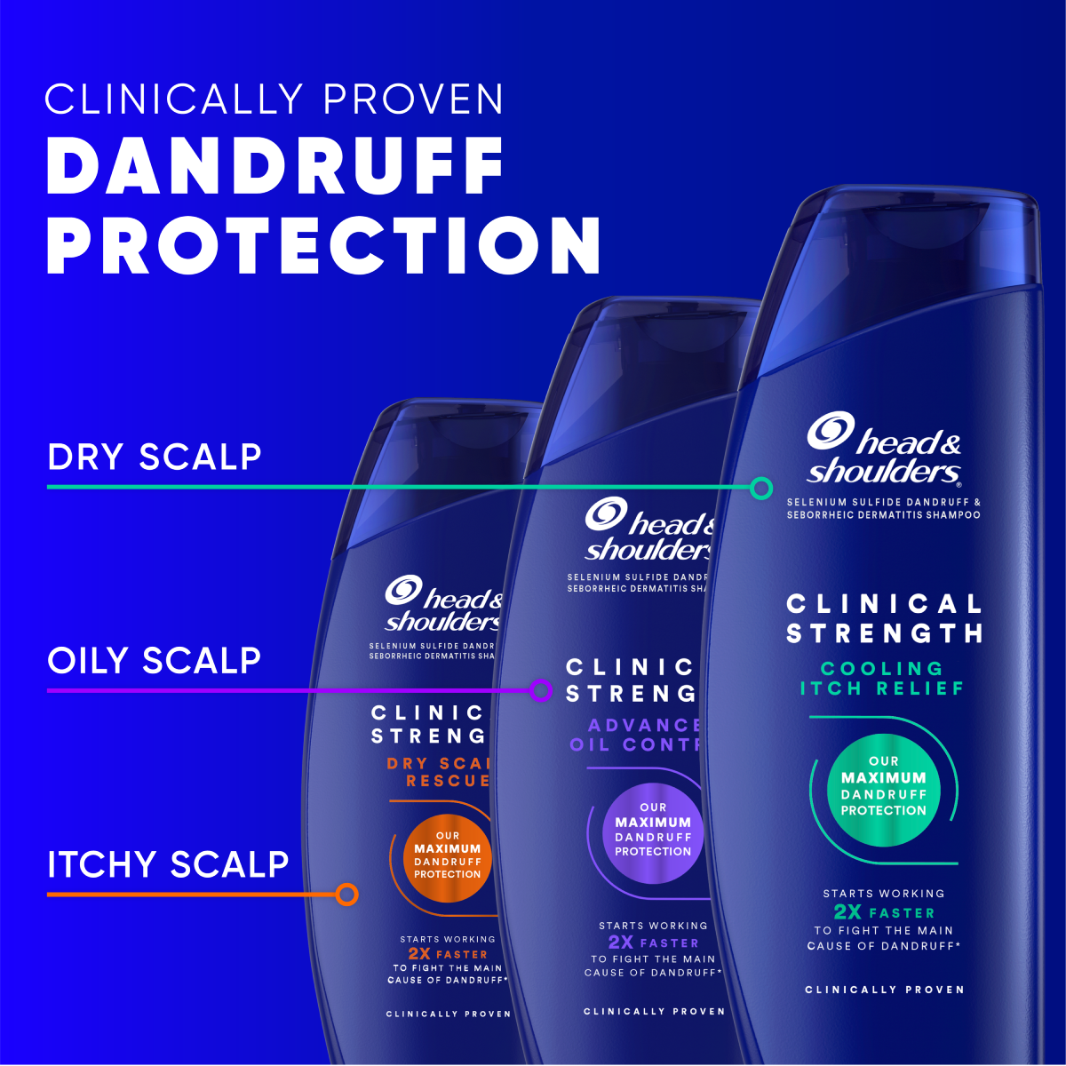 Seborrhoeic Dermatitis Scalp Shampoo
