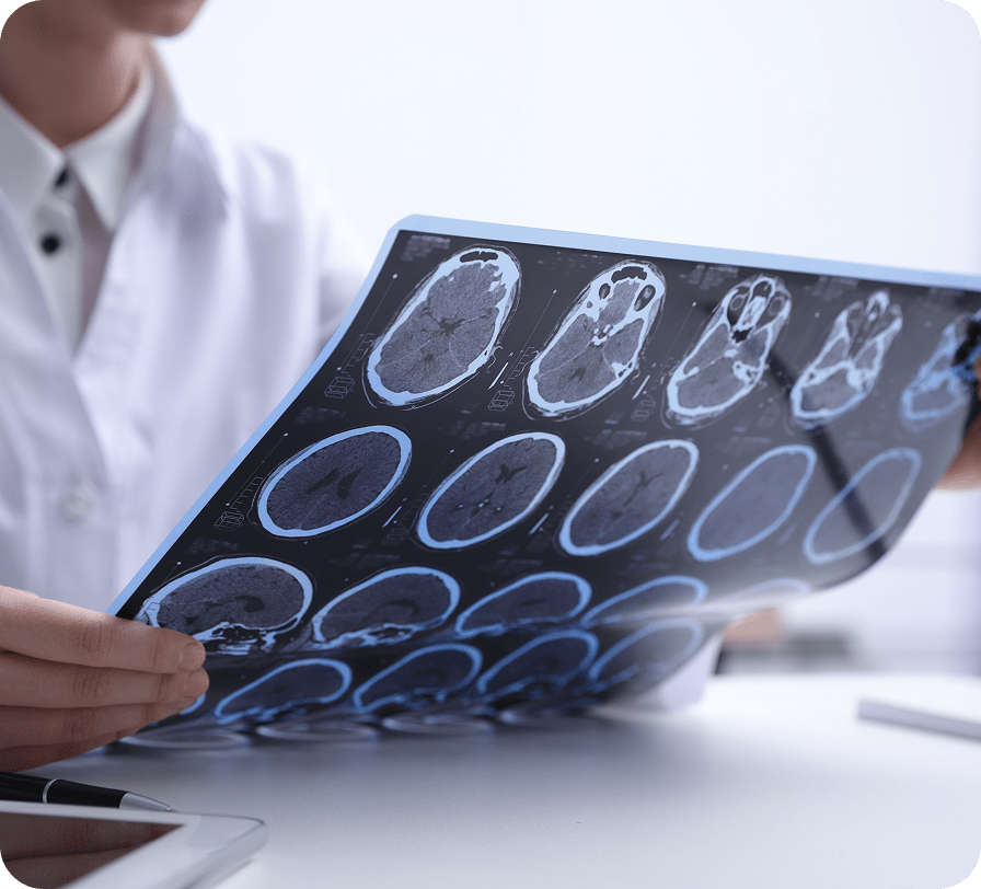 Doctor examining MRI images of patient with multiple sclerosis at table ...