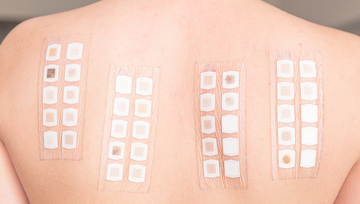 Allergic Reactions on The Lips: Causes and Treatments | LifeMD